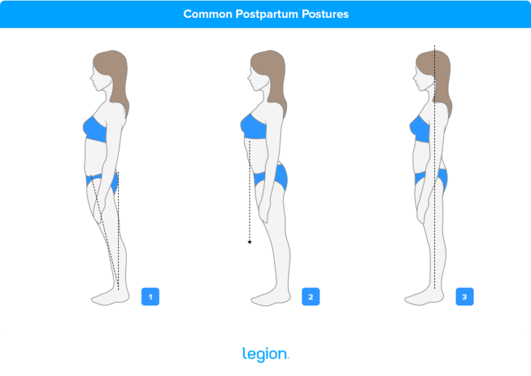 Diastasis Recti Exercises: Everything You Need to Know About How to Fix ...