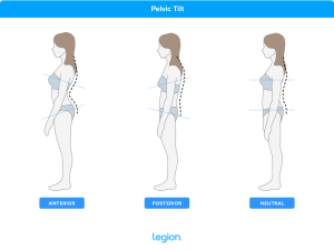 Anterior Pelvic Tilt: Fixes, Symptoms, and Exercises | An Evidence ...