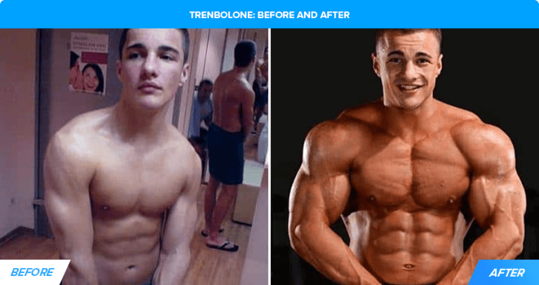 Trenbolone Acetate: What is Tren & It's Effects? | Legion