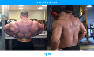 Steroids vs Natty: How to Tell if Someone is Not Natty | Legion