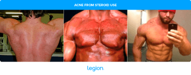 Stanozolol (Winstrol): Cycle, Benefits, and Side Effects Explained